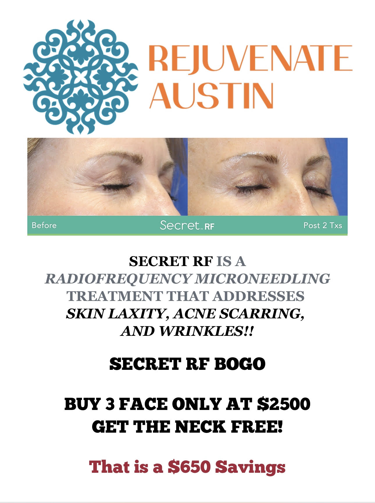Specials - Rejuvenate Austin - Austin’s Premier Medspa